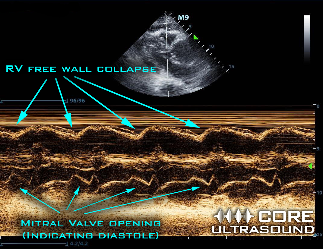 UOTW #91 - Core Ultrasound