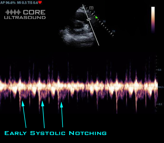 UOTW #90 - Core Ultrasound