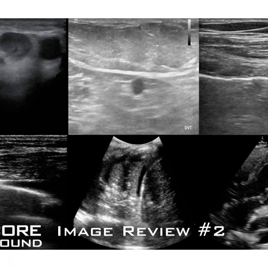 Core Ultrasound Image Review #3 – Core Ultrasound