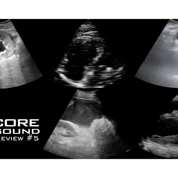 Core Ultrasound Image Review #1 – Core Ultrasound