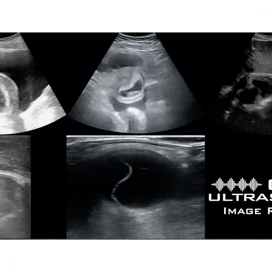 Core Ultrasound Image Review #1 - Core Ultrasound