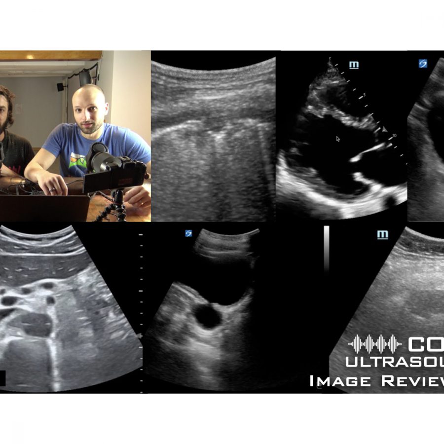 Core Ultrasound Image Review, Episode 8 – Core Ultrasound