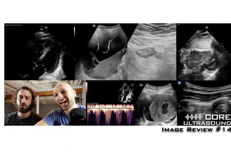 Image Review - Core Ultrasound