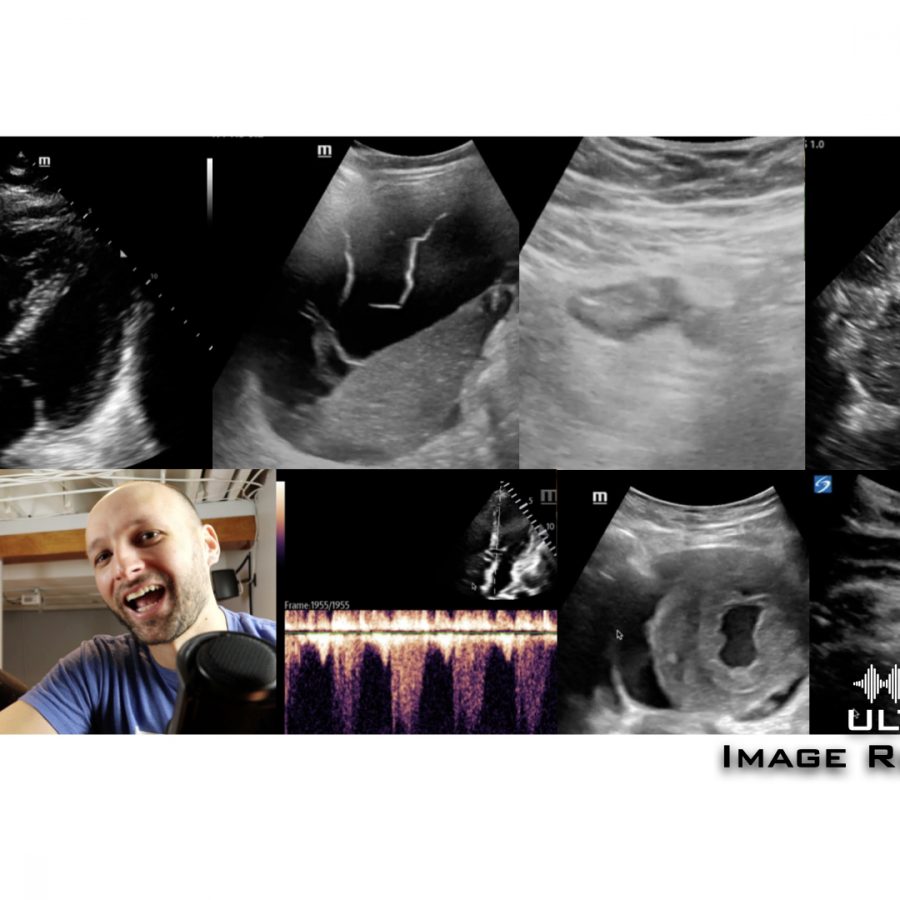 Core Ultrasound Image Review, Episode 7! - Core Ultrasound