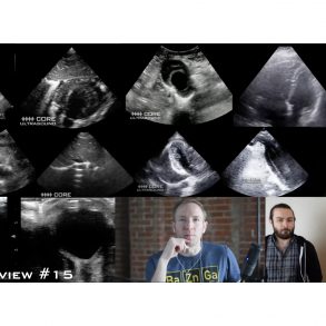 Core Ultrasound Image Review #3 - Core Ultrasound