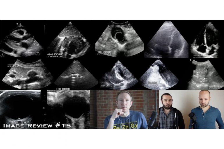 Image Review - Core Ultrasound