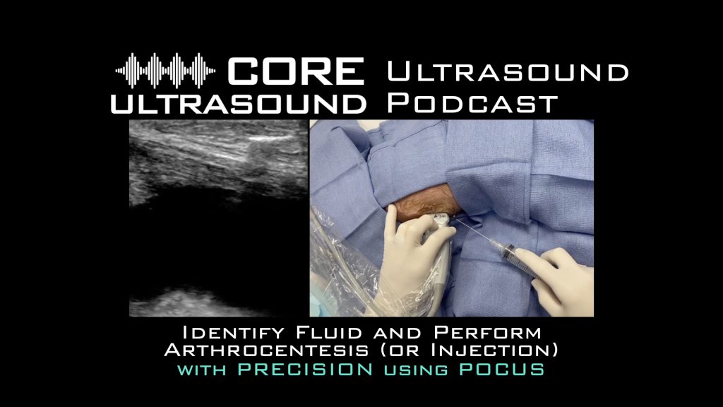 Large Joint Arthrocentesis and Injection – Core Ultrasound