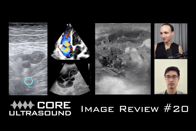 Image Review - Core Ultrasound