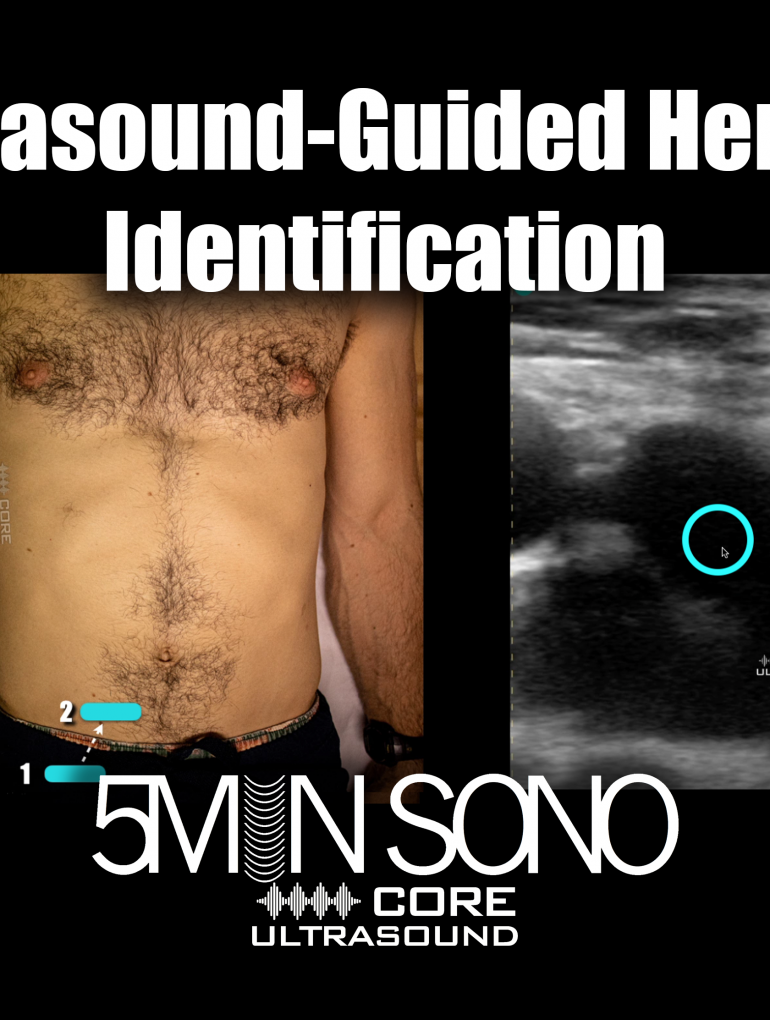 5 Minute Sono – Core Ultrasound